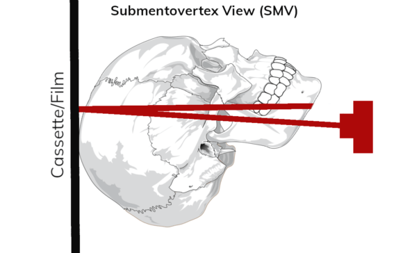 indications of SMV Archives - Dental Pockets Blog